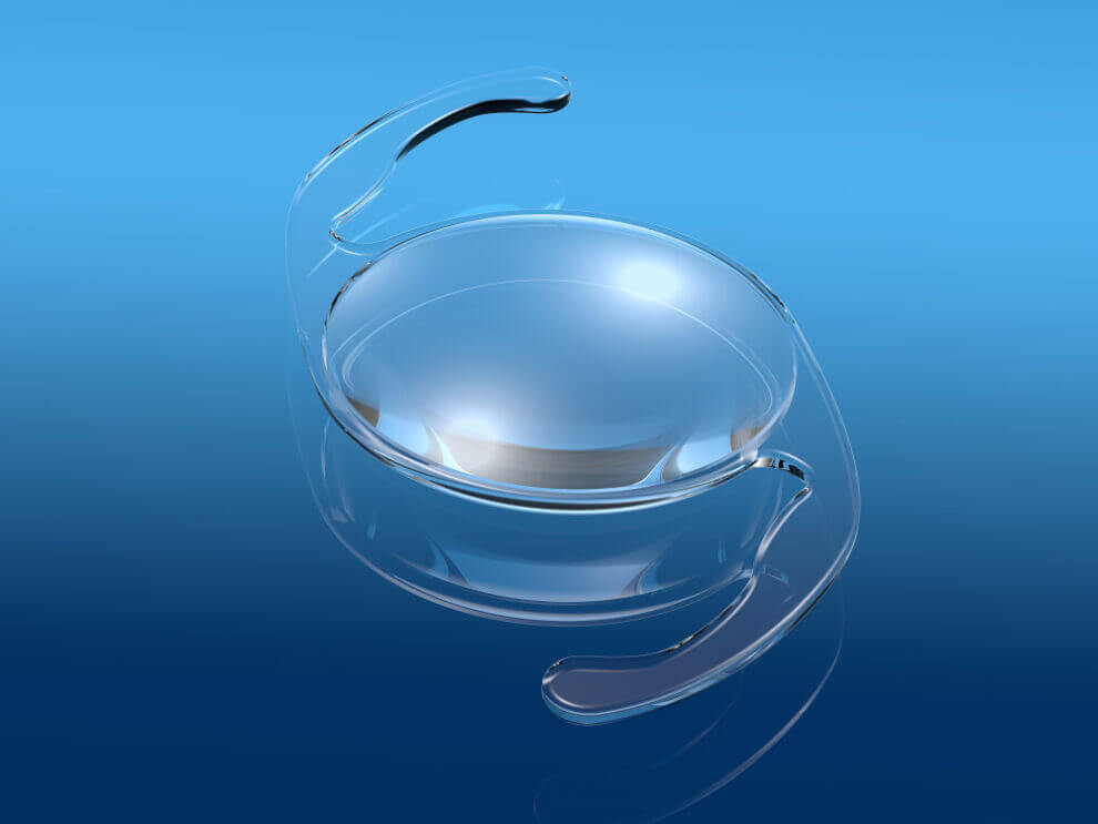 Cataract Surgery New York City | Lens Implants New York, NY